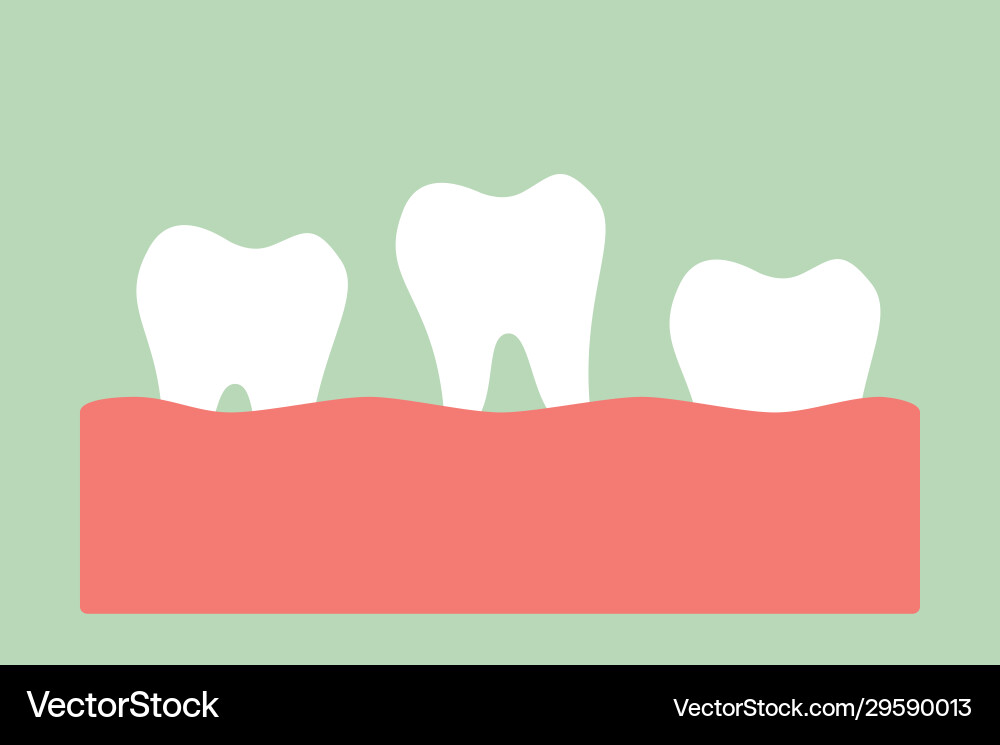 Loose tooth - tooth is fall out from gum Vector Image