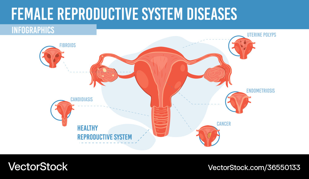 Flat cartoon infographic female reproductive Vector Image