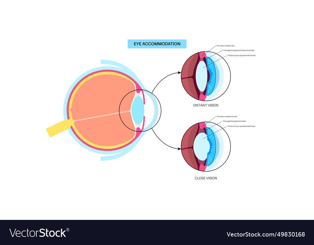 Eye accommodation poster Royalty Free Vector Image