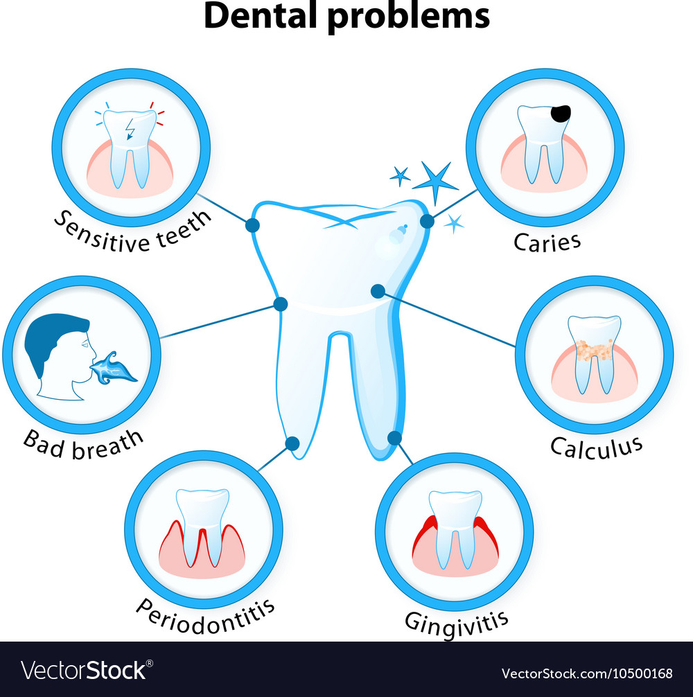 Tooth problem Royalty Free Vector Image - VectorStock