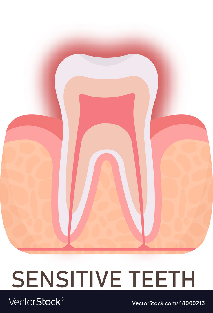 Sensitive tooth problem Royalty Free Vector Image