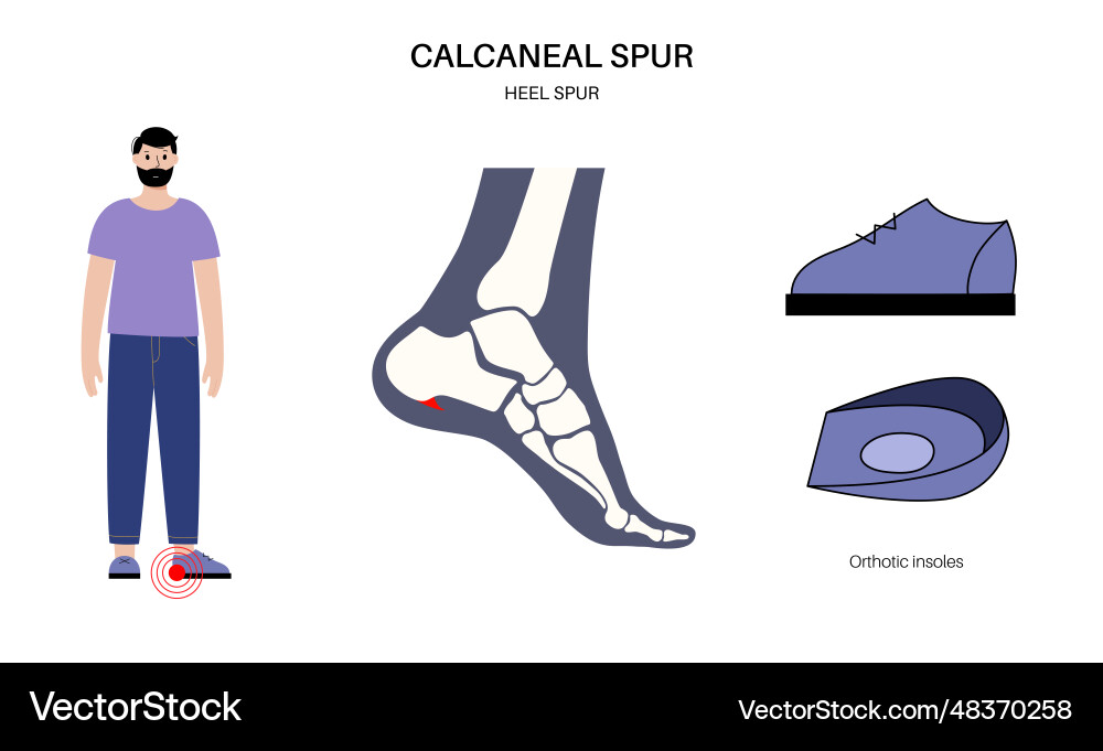Orthotic shoe and insoles Royalty Free Vector Image