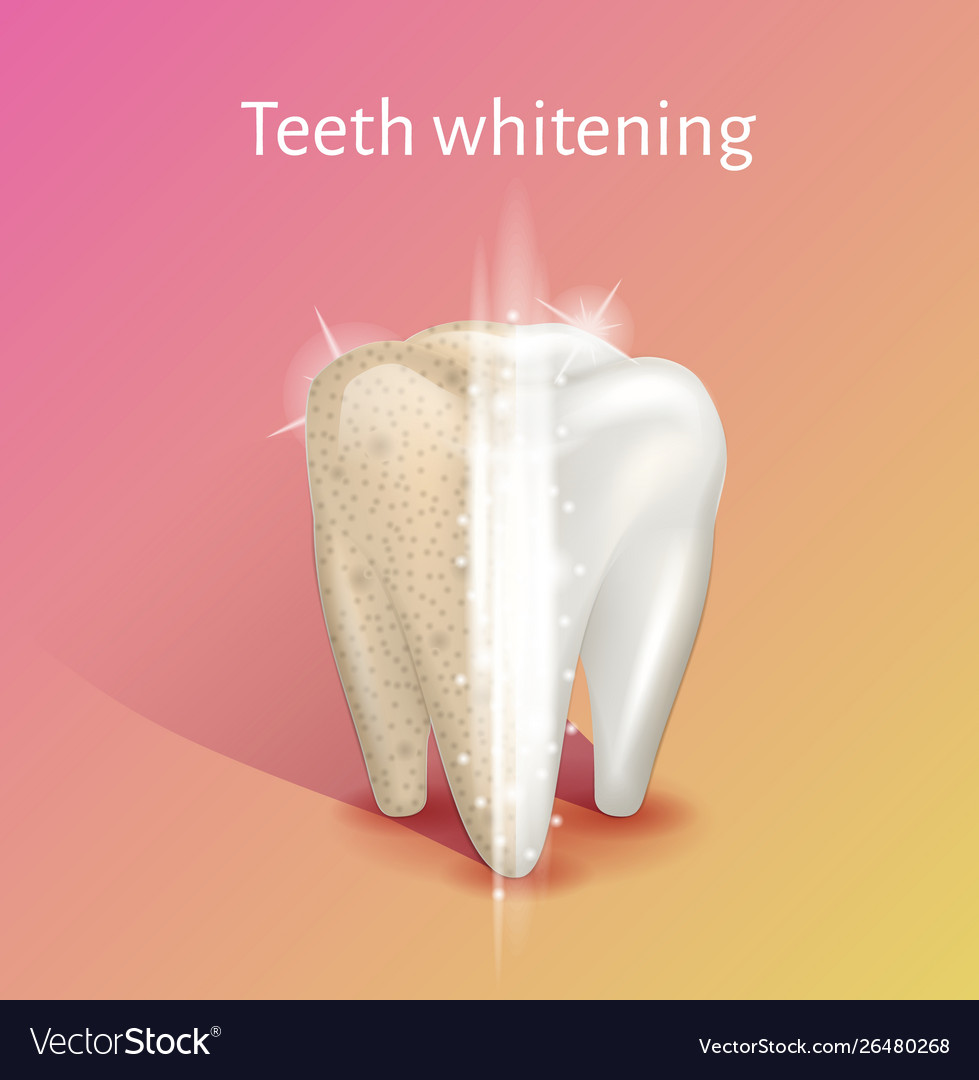 Tooth whitening in realistic 3d Royalty Free Vector Image