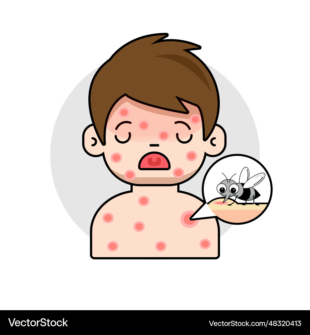 Child has red rashes on his body Royalty Free Vector Image
