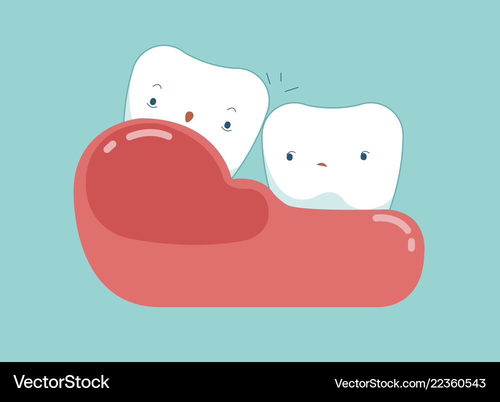 Gingivitis of dental Royalty Free Vector Image