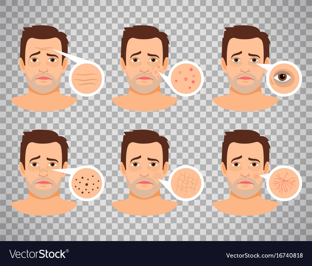 Man skin problems Royalty Free Vector Image - VectorStock