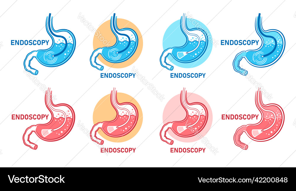Endoscopy stomach gastroscopy medical diagnostic Vector Image
