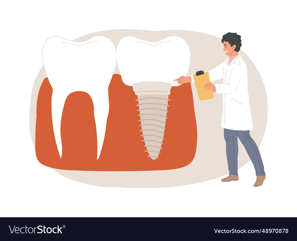 Teeth dentures implants isolated concept Vector Image