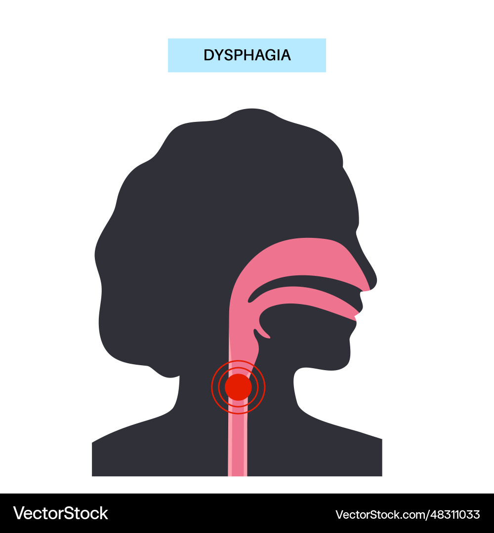 Dysphagia medical poster Royalty Free Vector Image