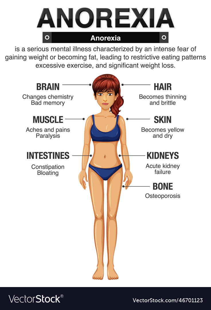 Anorexia and its effects on the body Royalty Free Vector