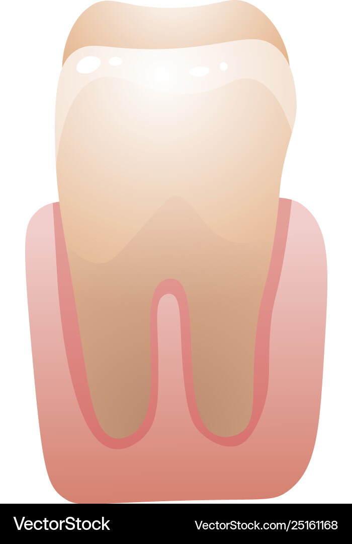 Yellow white tooth with dental stone ready Vector Image