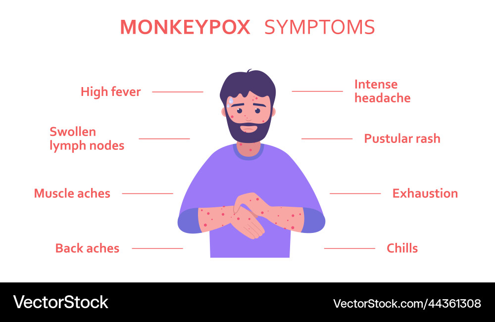 Monkeypox virus symptoms inforgraphic with man Vector Image