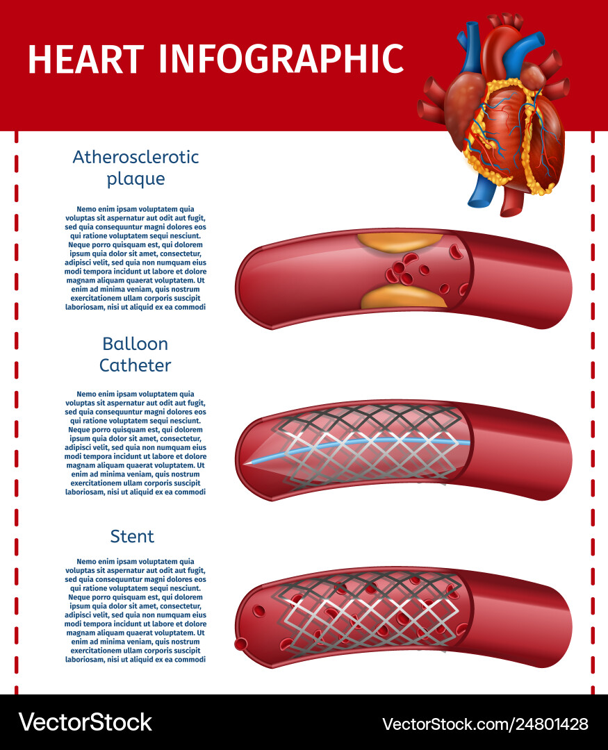 Realistic heart infographic surgery therapy banner