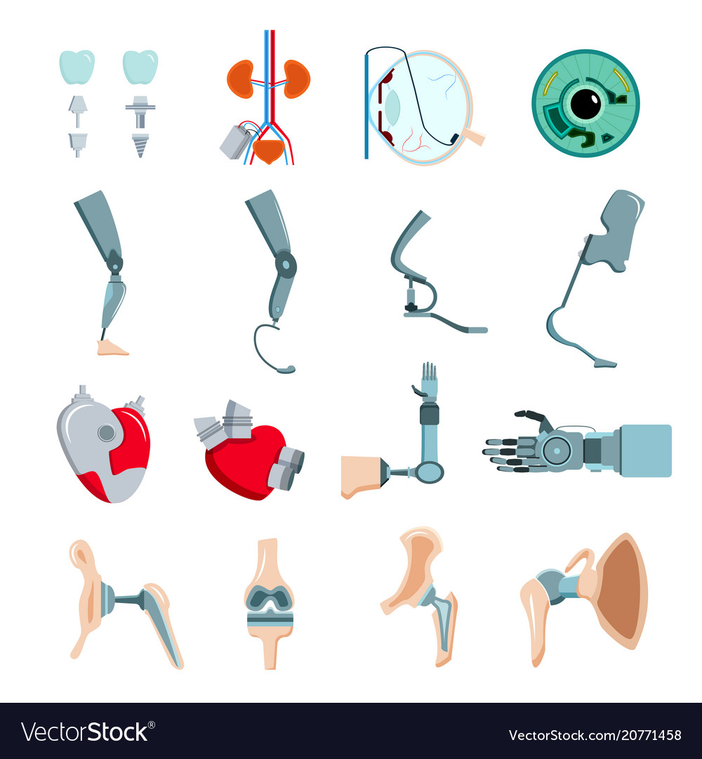Prothesis implants flat set Royalty Free Vector Image