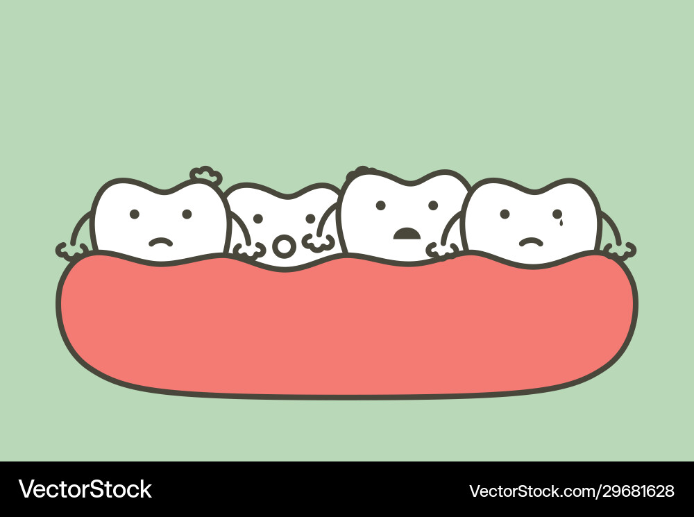 Crowding teeth or malocclusion Royalty Free Vector Image