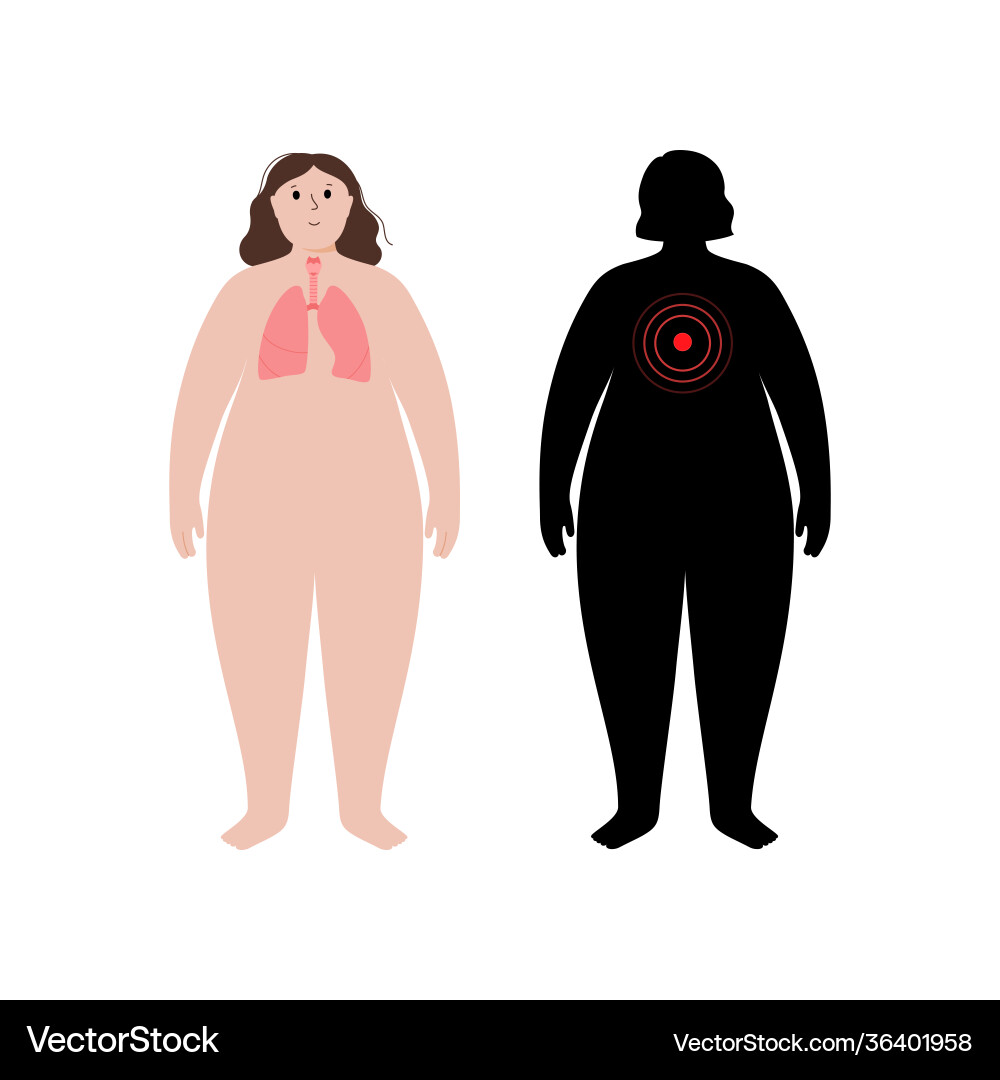Organs in obese human body Royalty Free Vector Image