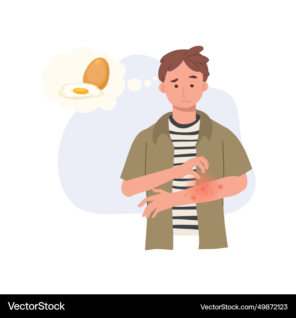 Egg allergy reaction man with itchy red rash Vector Image