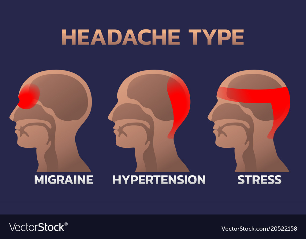 Types Headaches Infographics Design Template Vector Image