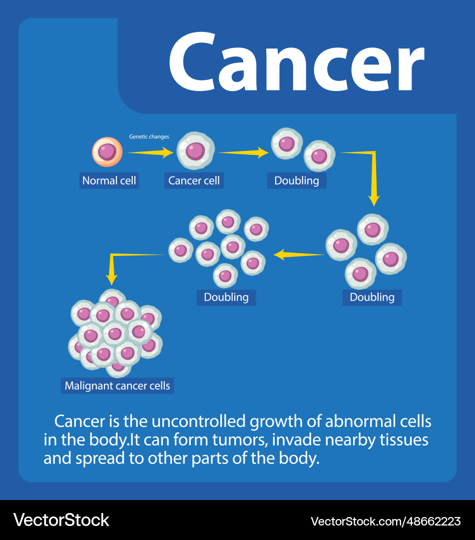 Processing of cancer cells an infographic Vector Image