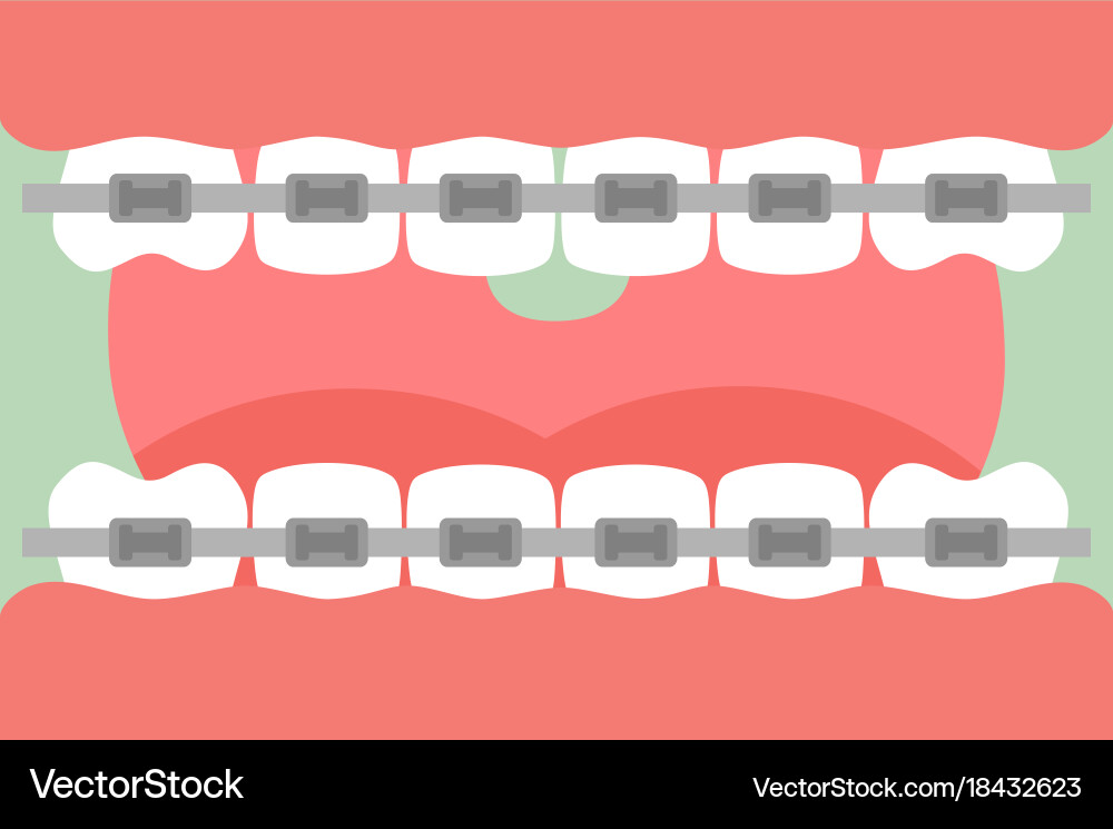 Orthodontics teeth or dental braces Royalty Free Vector