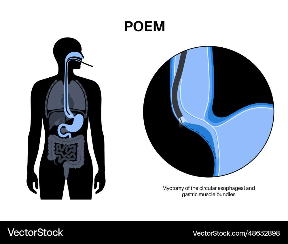 Poem medical poster Royalty Free Vector Image - VectorStock