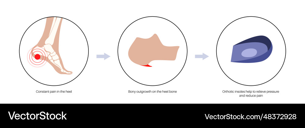 Orthotic shoe and insoles Royalty Free Vector Image