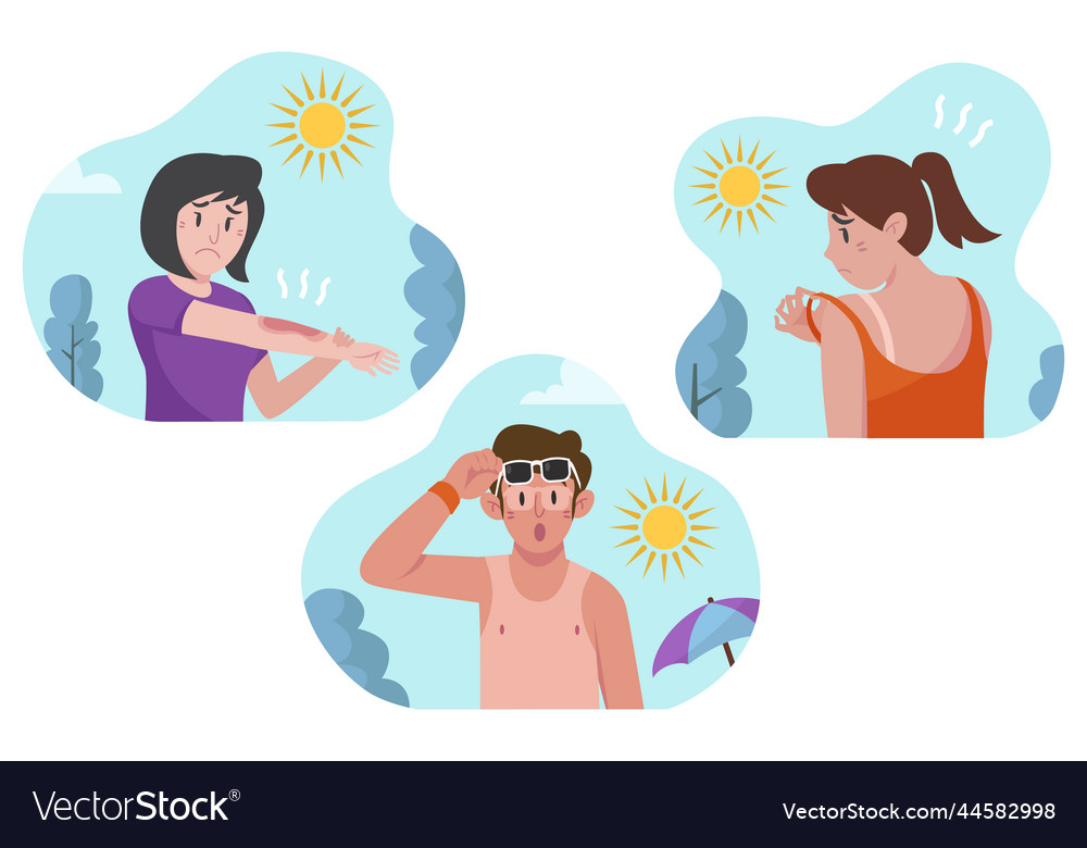 Different People With Sunburn Set Royalty Free Vector Image