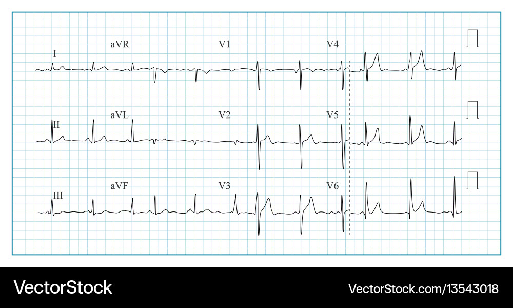 Heart cardiogram chart of Royalty Free Vector Image