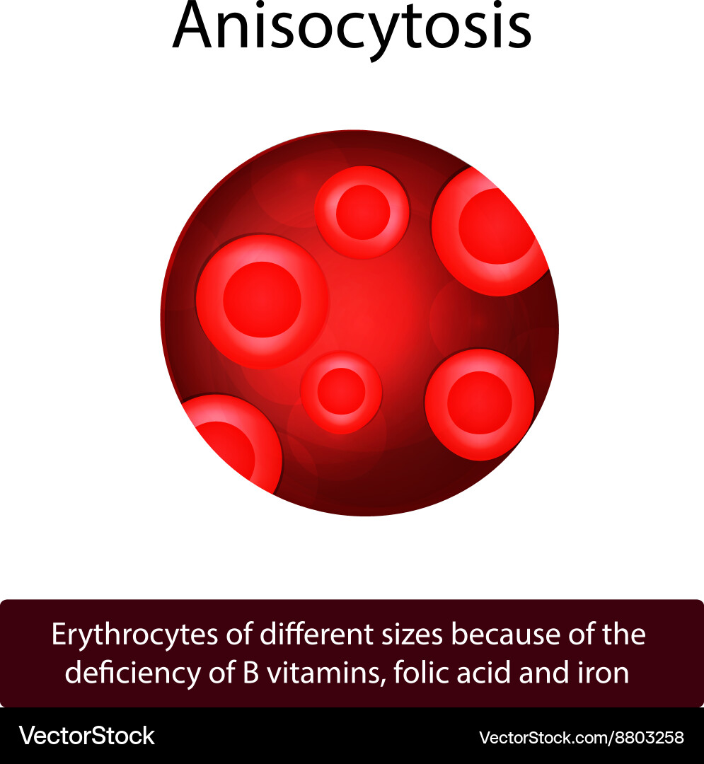 Anisocytosis red blood cells different sizes Vector Image