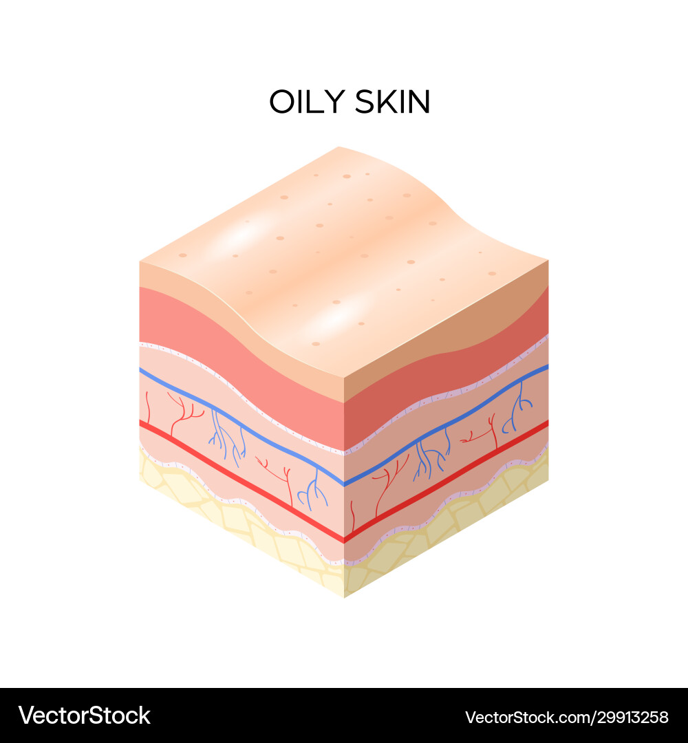 Oily skin cross-section human layers Royalty Free Vector