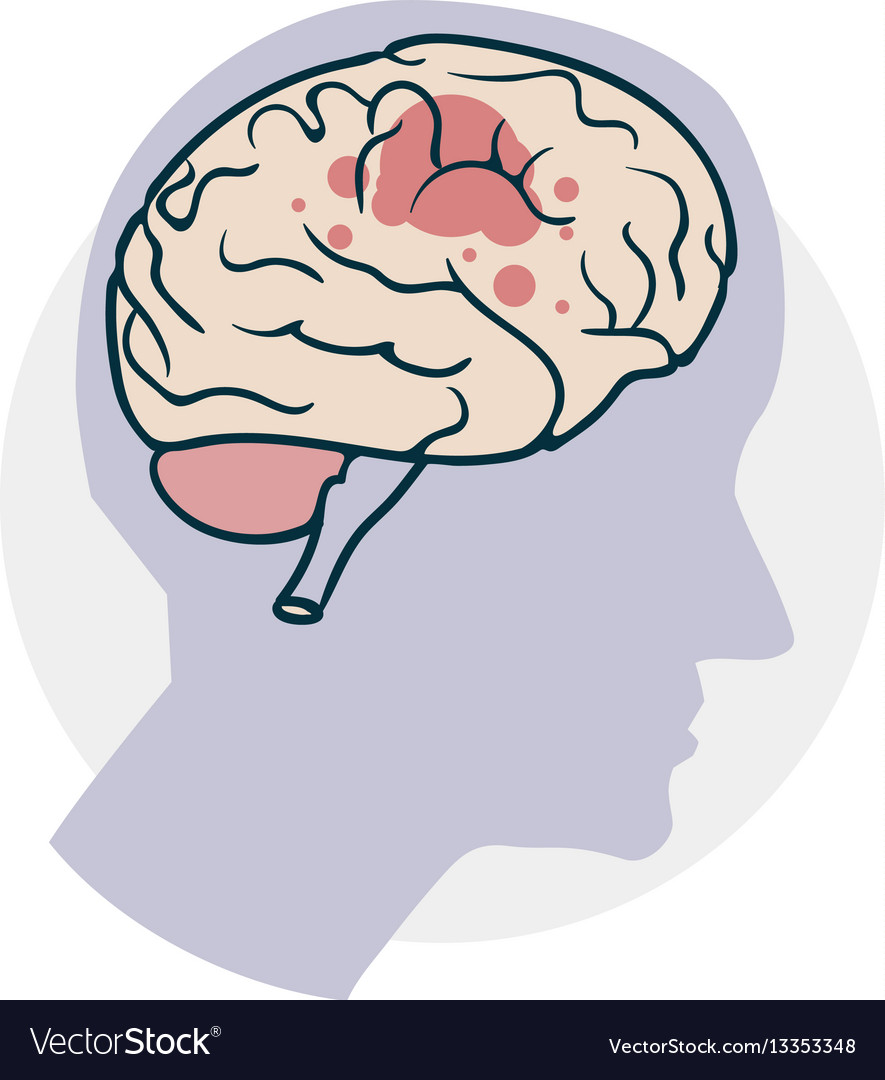 Problems with the brain Royalty Free Vector Image