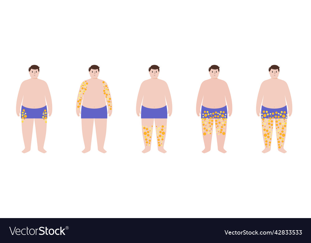 Overweight problem concept Royalty Free Vector Image