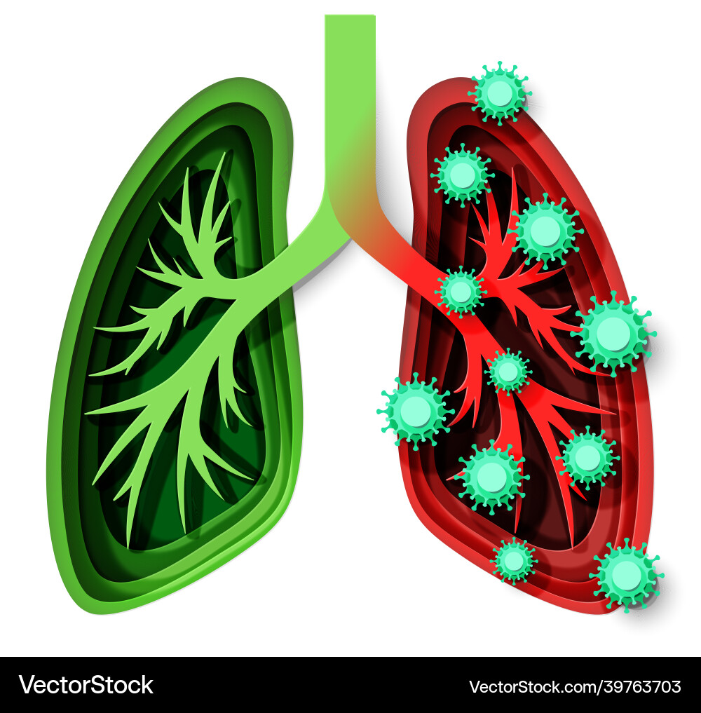 Human lungs healthy and infected with virus Vector Image