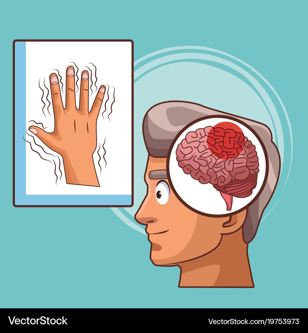 Parkinsons Disease Cartoon PARKINSON'S DISEASE And Pathophysiology