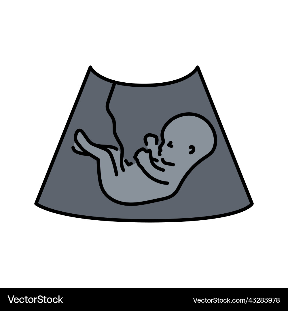 Ultrasound embryo color line Royalty Free Vector Image