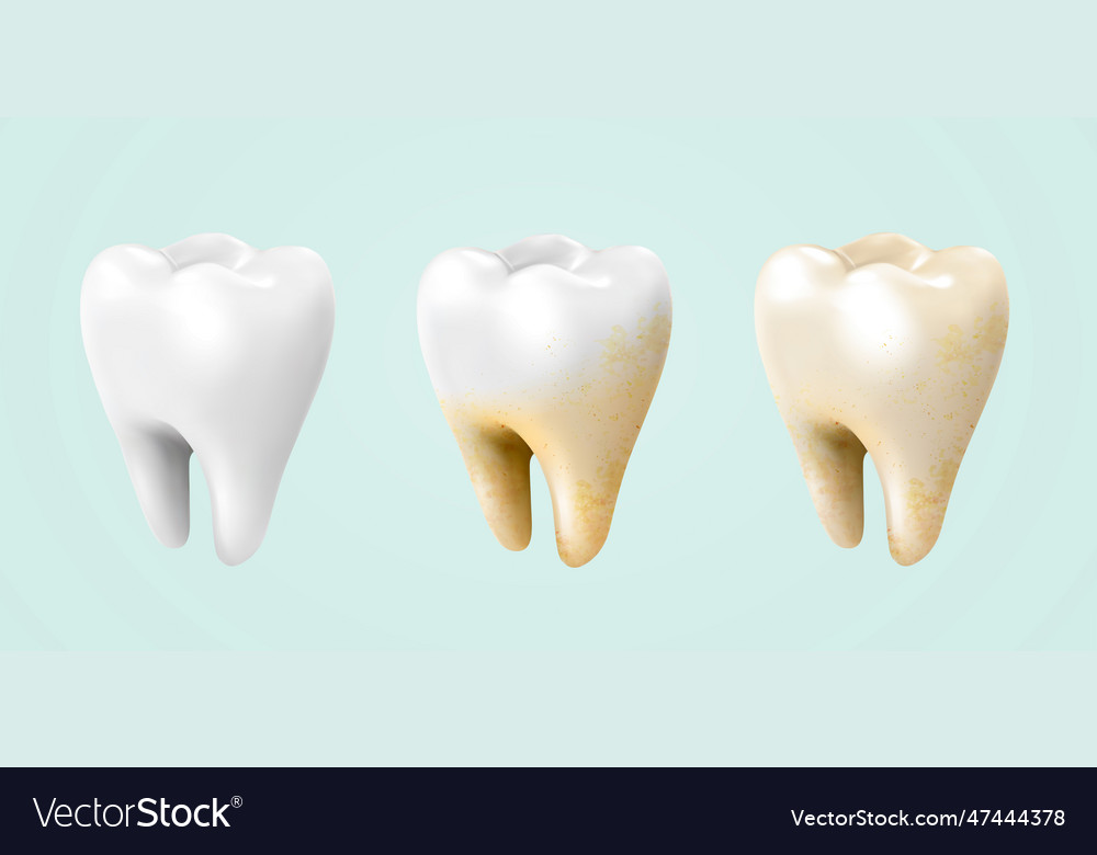 Teeth whitening treatment Royalty Free Vector Image