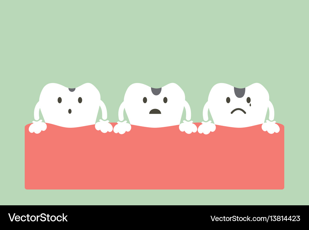 Stages of tooth decay Royalty Free Vector Image
