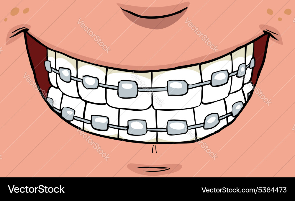 Teeth with braces Royalty Free Vector Image - VectorStock