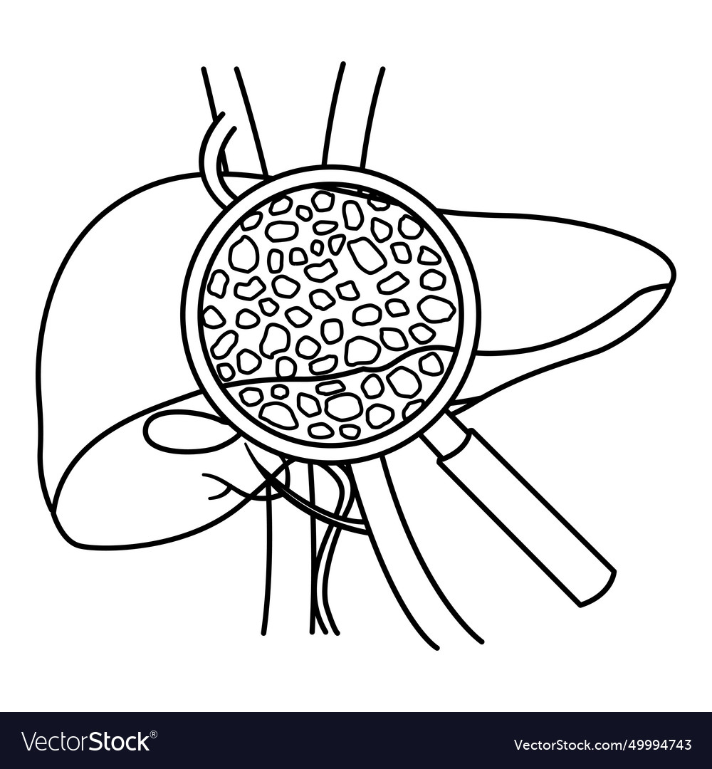 Liver disease for coloring page cirrhosis Vector Image