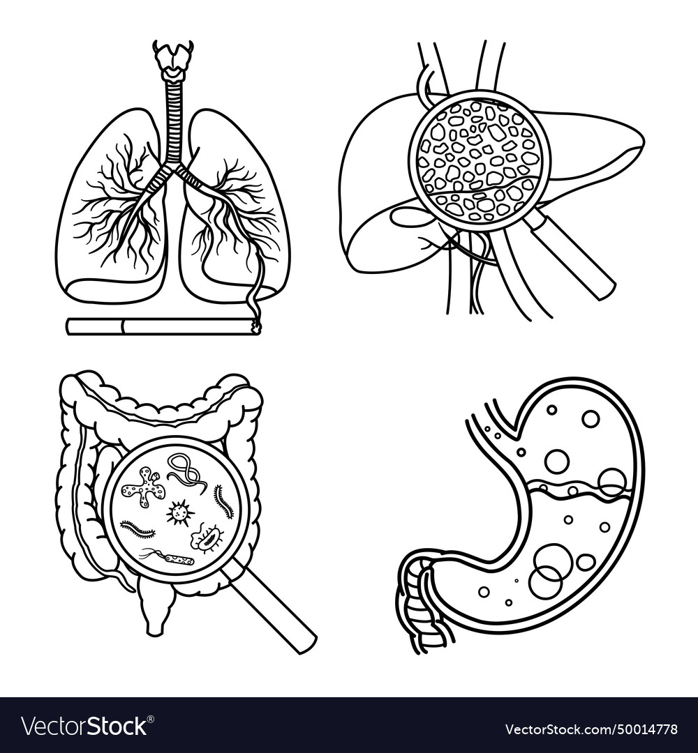 Anatomy of human organs with various diseases Vector Image