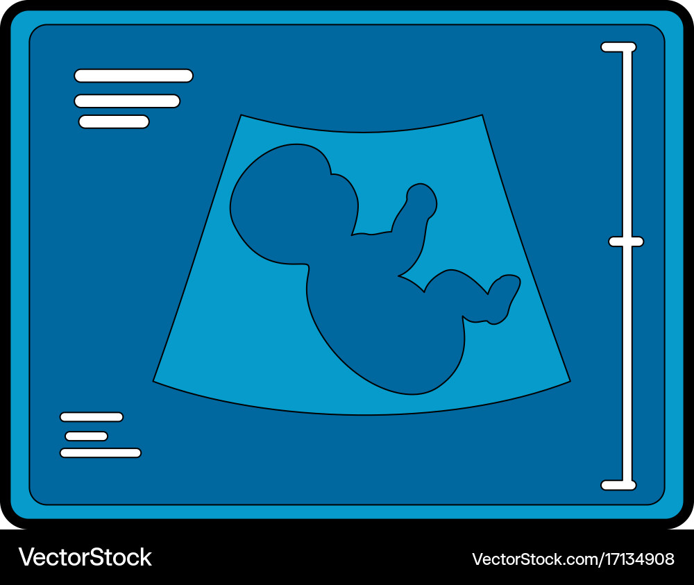 Baby ultrasound isolated icon Royalty Free Vector Image