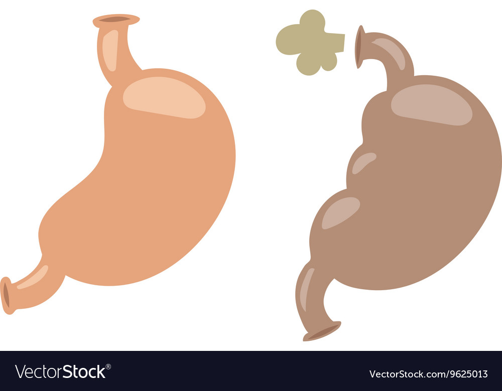 Digestive problems Royalty Free Vector Image - VectorStock
