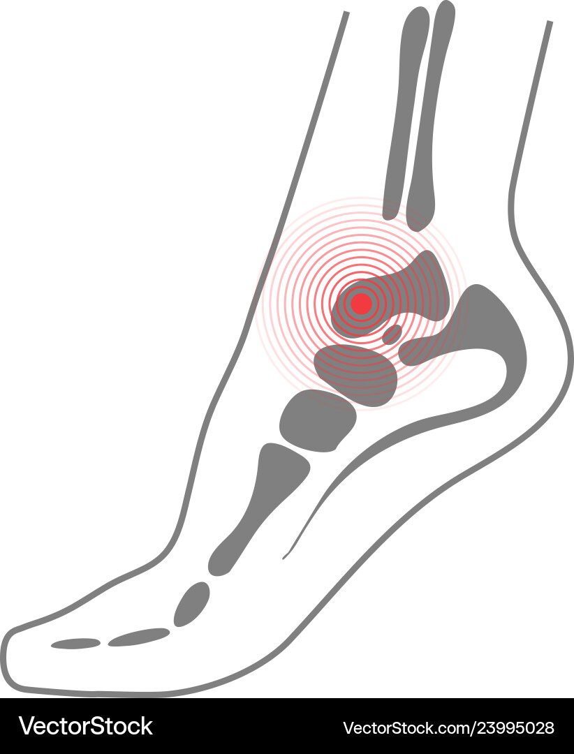 Foot sole with bones for biomechanics Royalty Free Vector