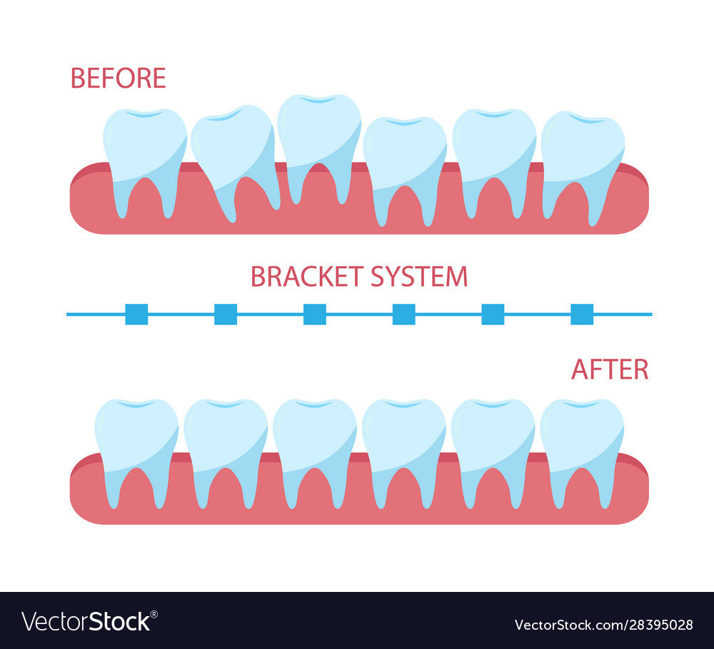 Poster bracket system flat style process Vector Image
