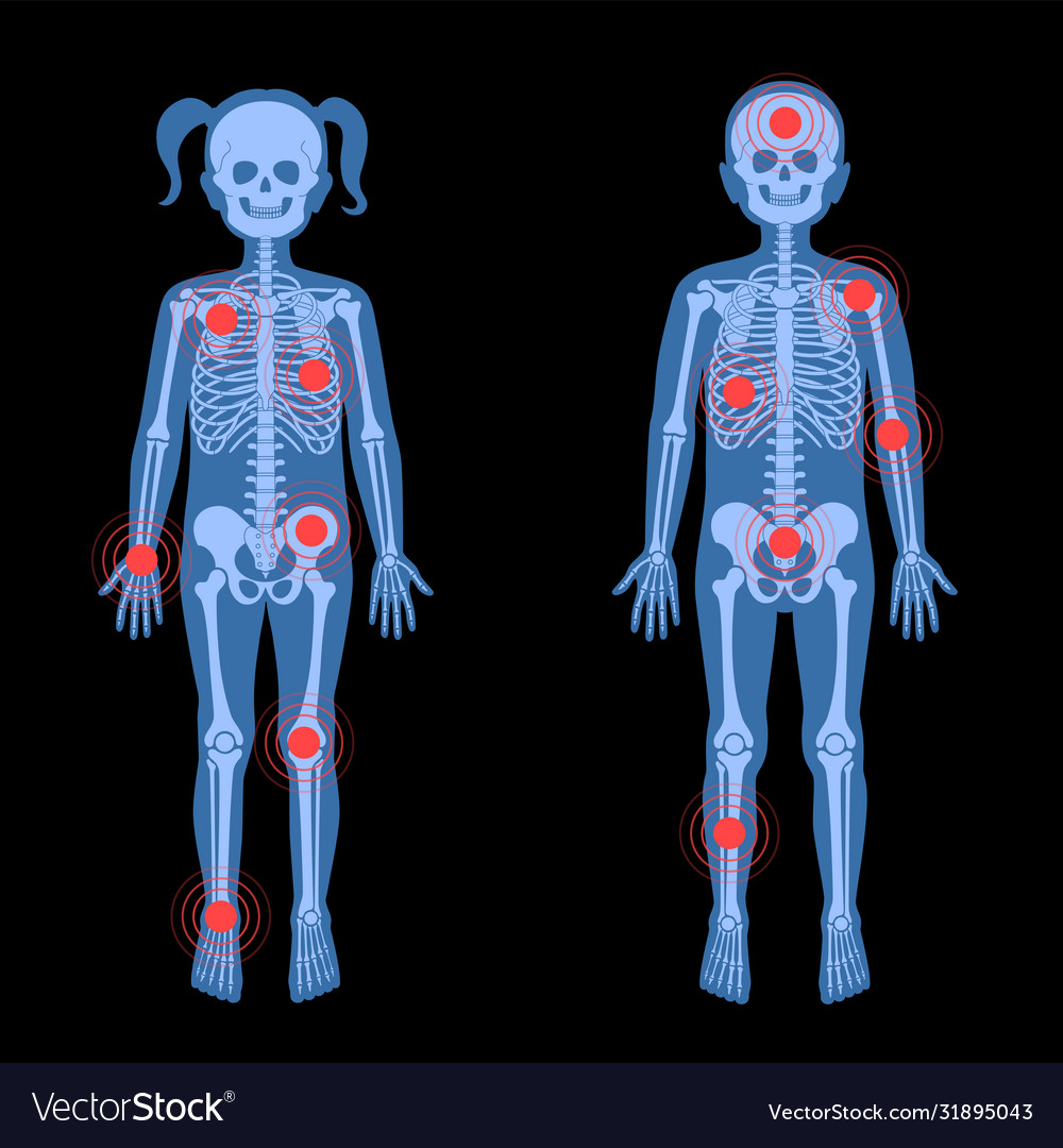 Skeleton x ray Royalty Free Vector Image - VectorStock