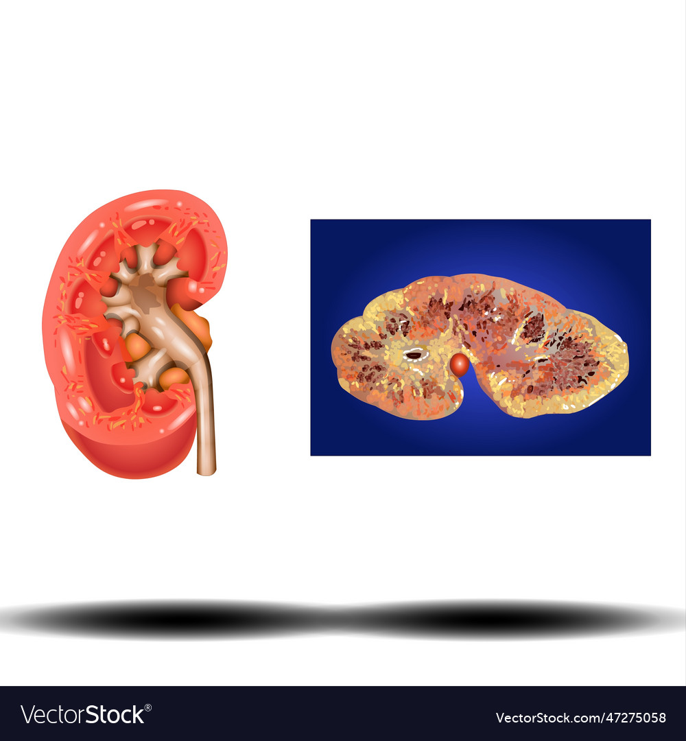 Kidney Royalty Free Vector Image - VectorStock