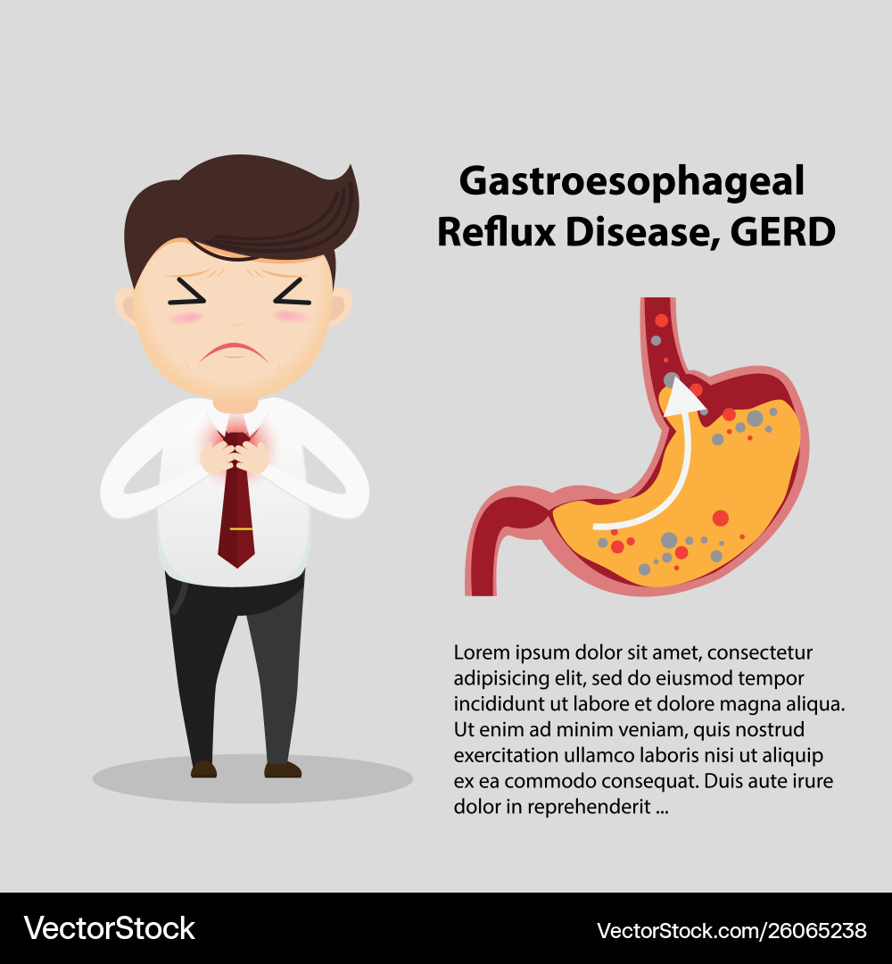 Gastro-esophageal reflux disease gerd Royalty Free Vector