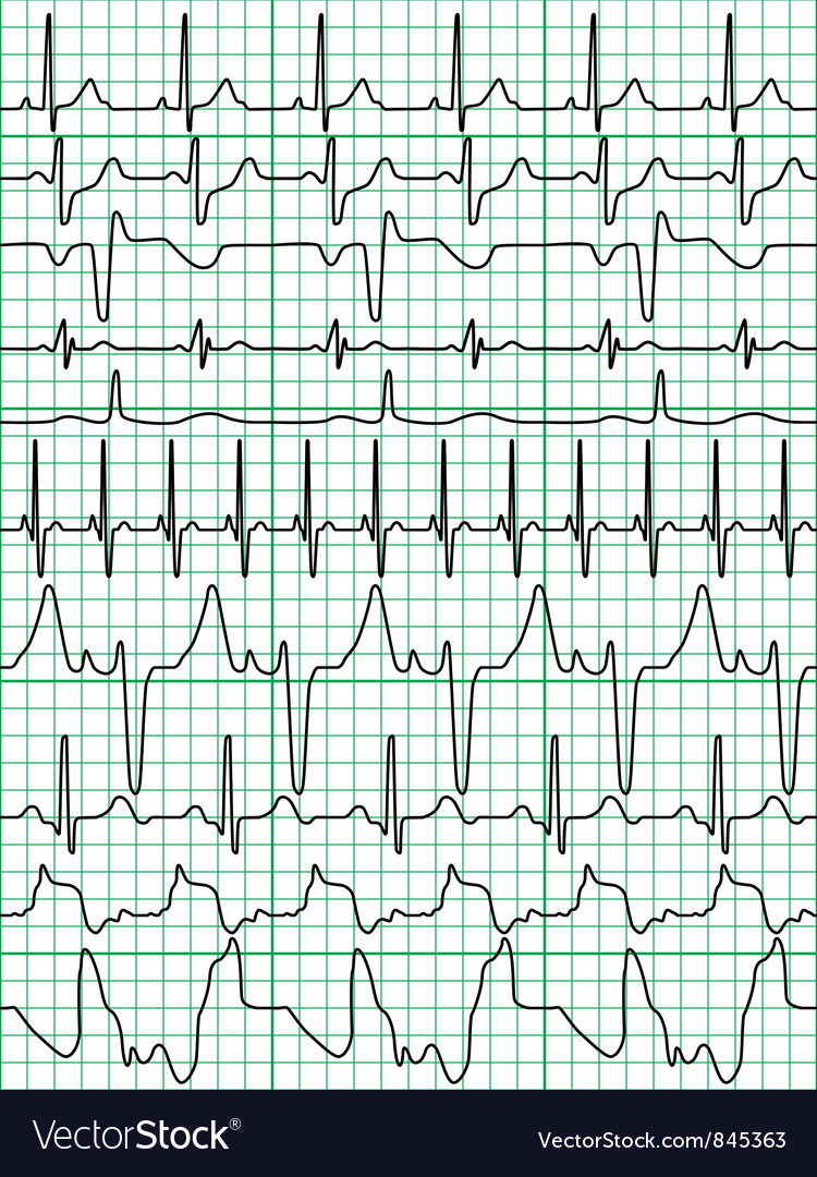 Cardiogram Royalty Free Vector Image - VectorStock