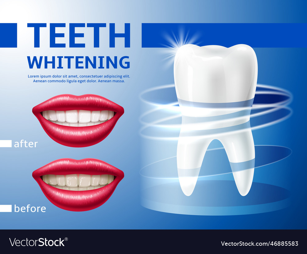 Teeth whitening poster realistic 3d smiling lips Vector Image
