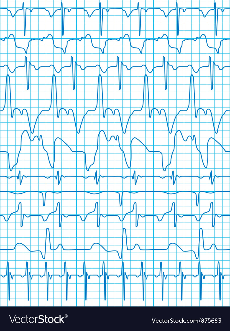 Cardiogram Royalty Free Vector Image - VectorStock